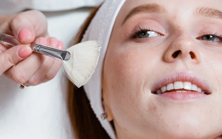 Chemical peeling 2025